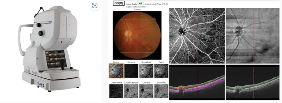 糖尿病眼外来｜糖尿病の合併症｜鹿児島市の眼科、宮田眼科 鹿児島